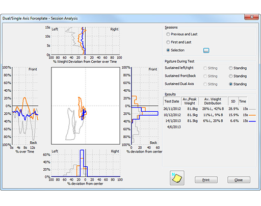 E-LINK フォースプレート | 株式会社Q'sfix