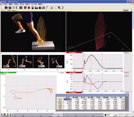TRIASⅡ | 株式会社Q'sfix